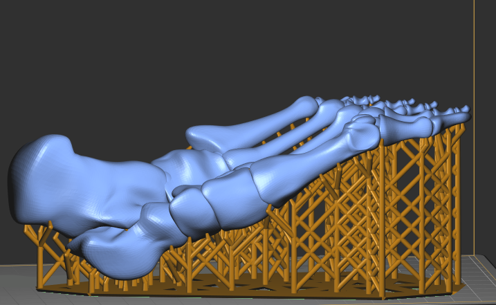 Introducing the Extra Fast Phenom Forge Profile